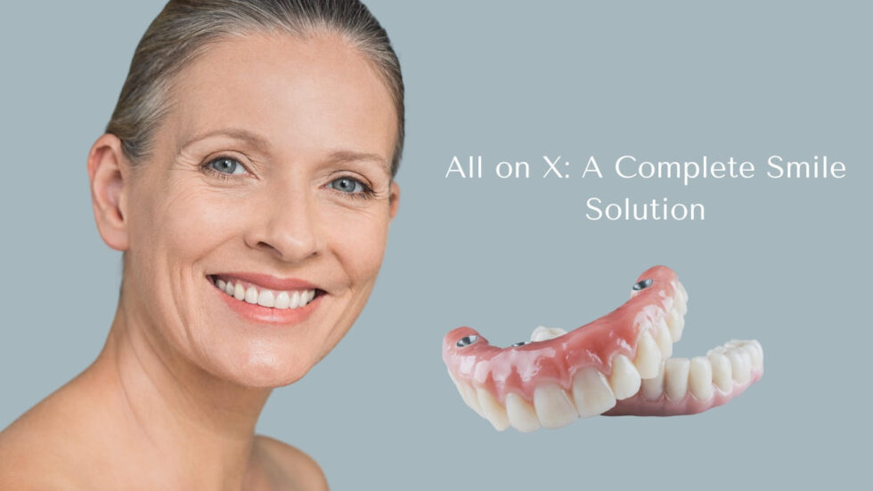 All-on-X Implants: A Complete Smile Solution | Manchester Rd Dental Surgery
